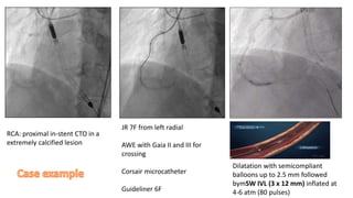 Alessio Mattesini: How to reduce periprocedural MACE rate in CTO PCI ...