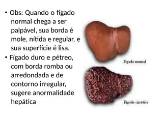 Semiologia-do-Abdomen com sinais e sintomas | PPTX