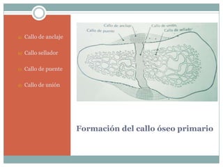 16425187 cicatrizacion-osea | PPTX