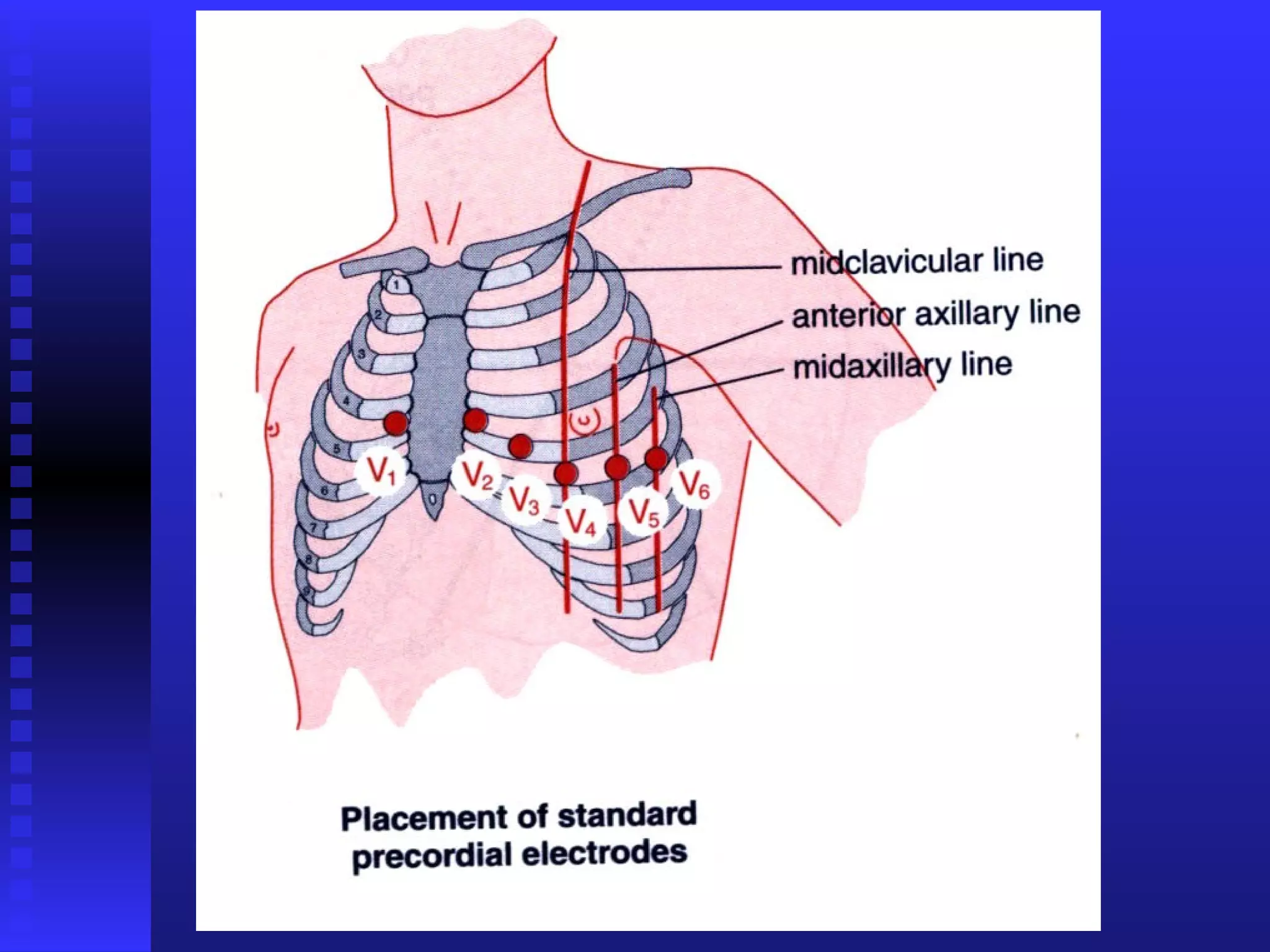 ekg-lengkap-ppt | PPT