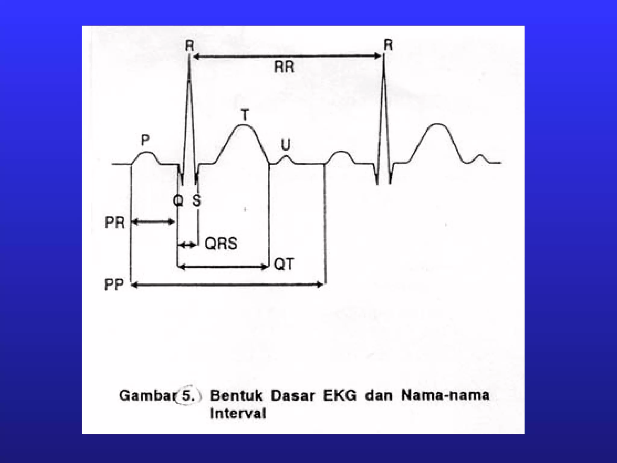 ekg-lengkap-ppt | PPT