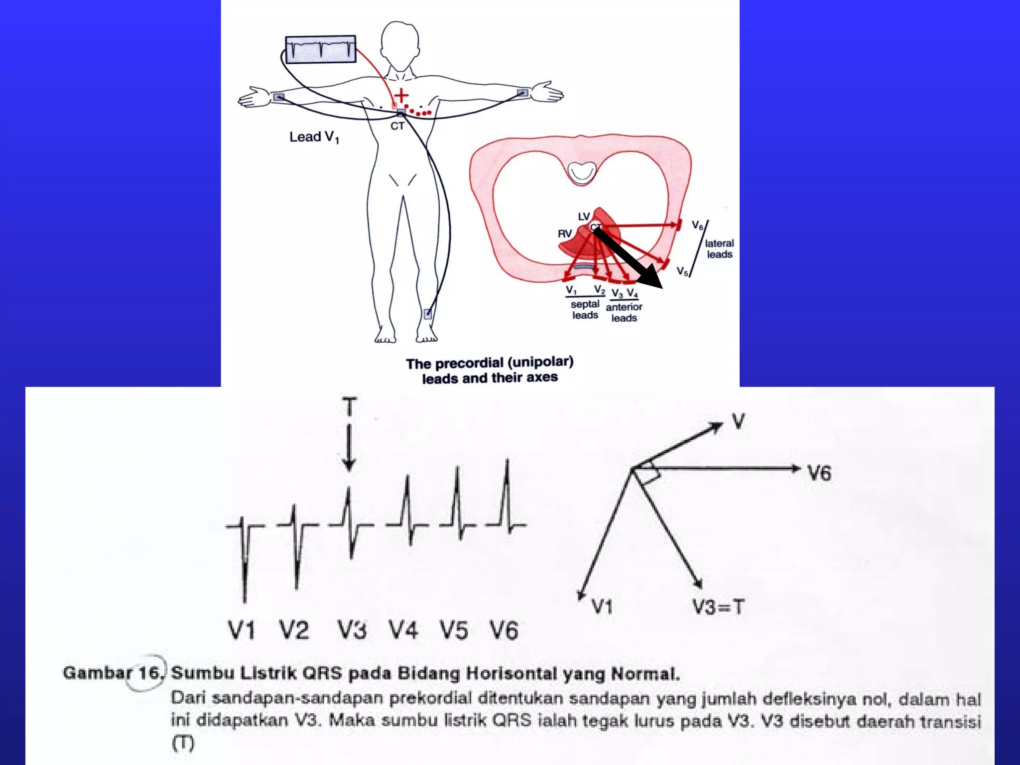 ekg-lengkap-ppt | PPT