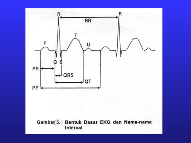ekg-lengkap-ppt | PPT