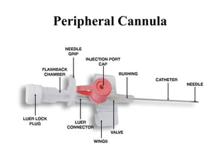 Cannulation | PDF