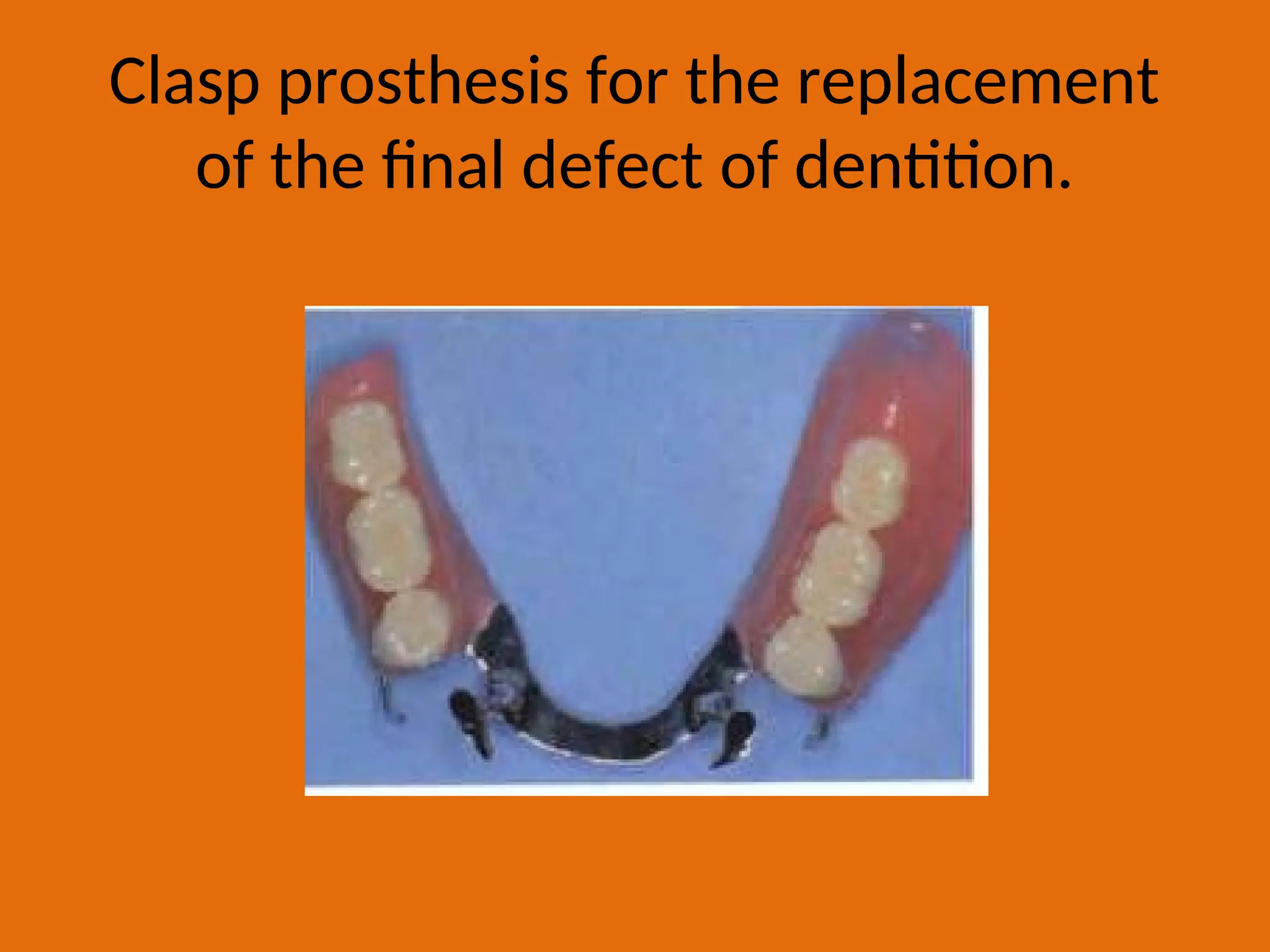 1659908partial denture classification .ppt