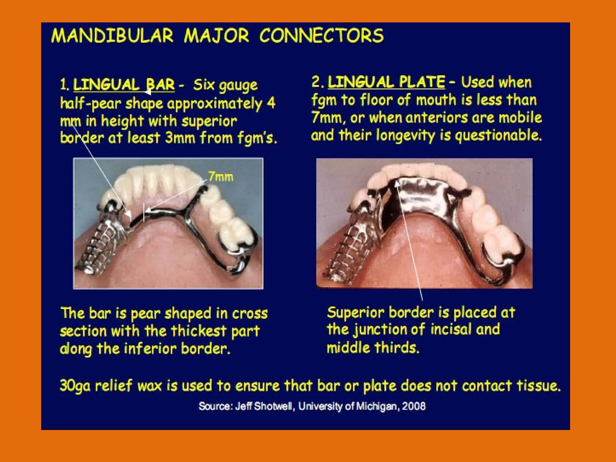 1659908partial denture classification .ppt 1659908partial denture classification .ppt
