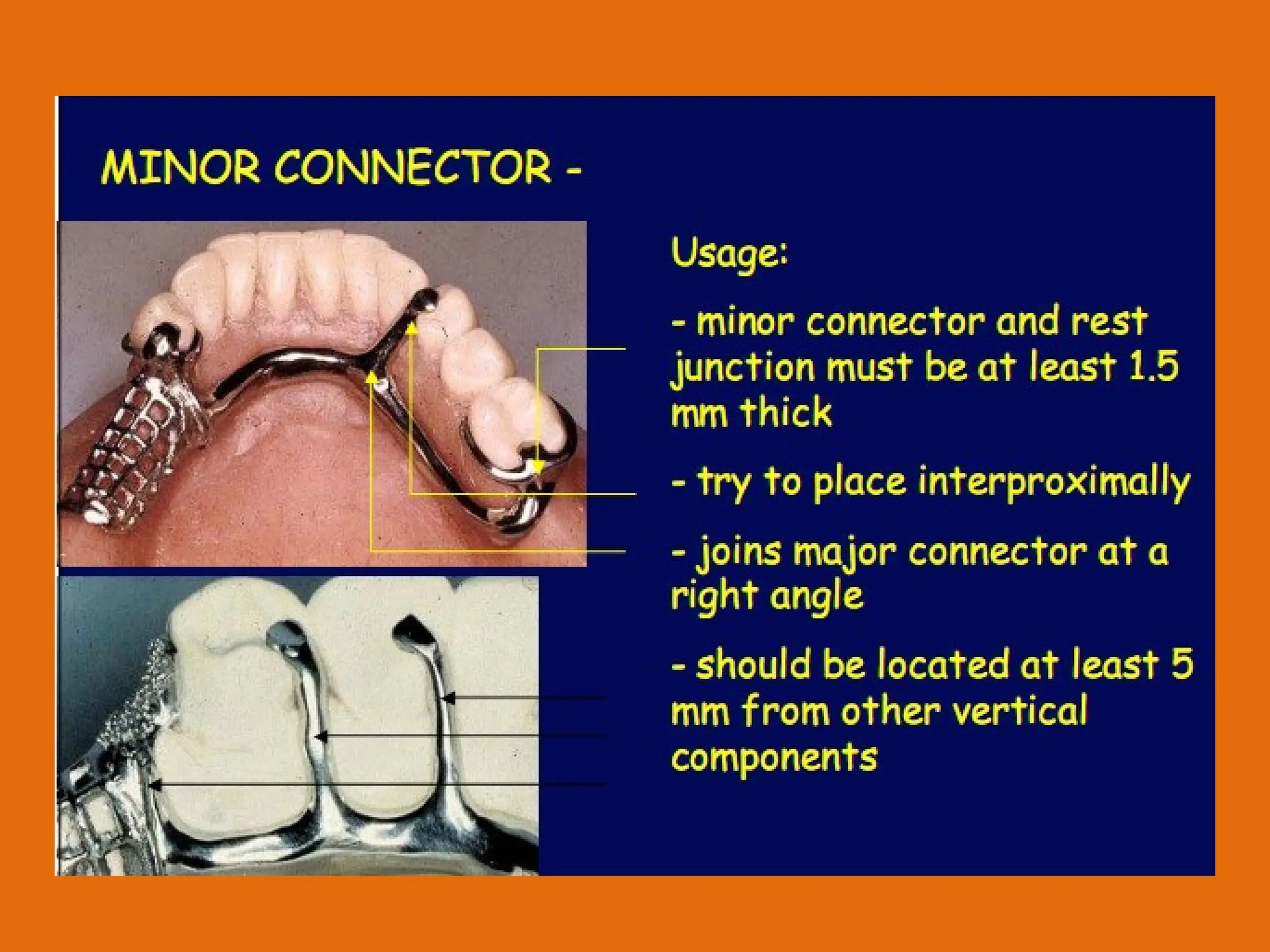 1659908partial denture classification .ppt