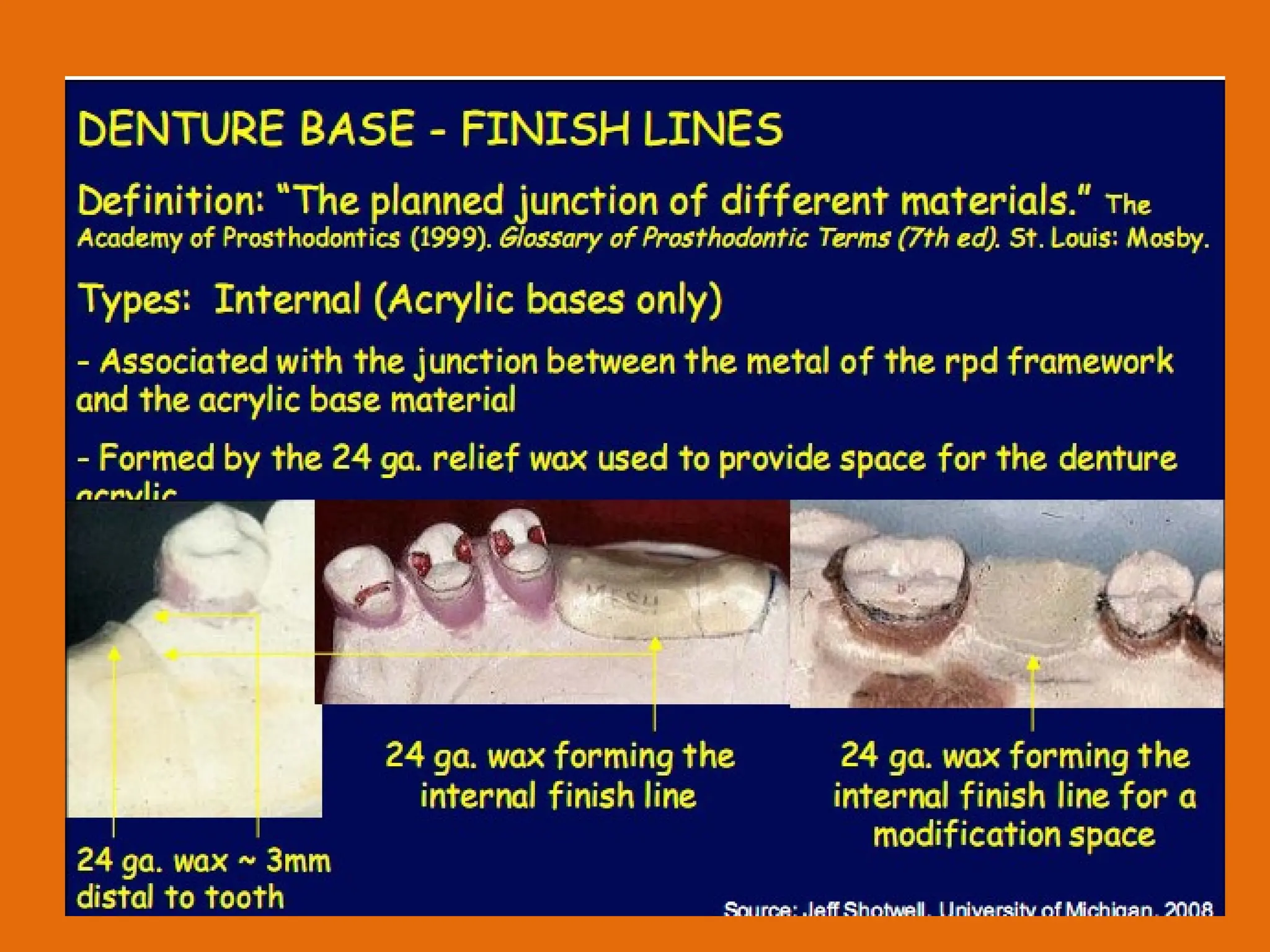 1659908partial denture classification .ppt