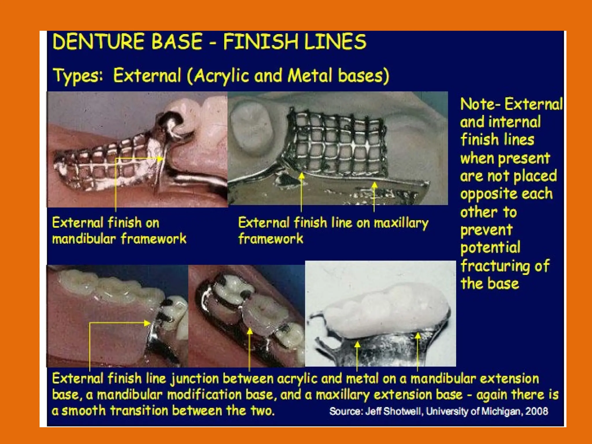 1659908partial denture classification .ppt