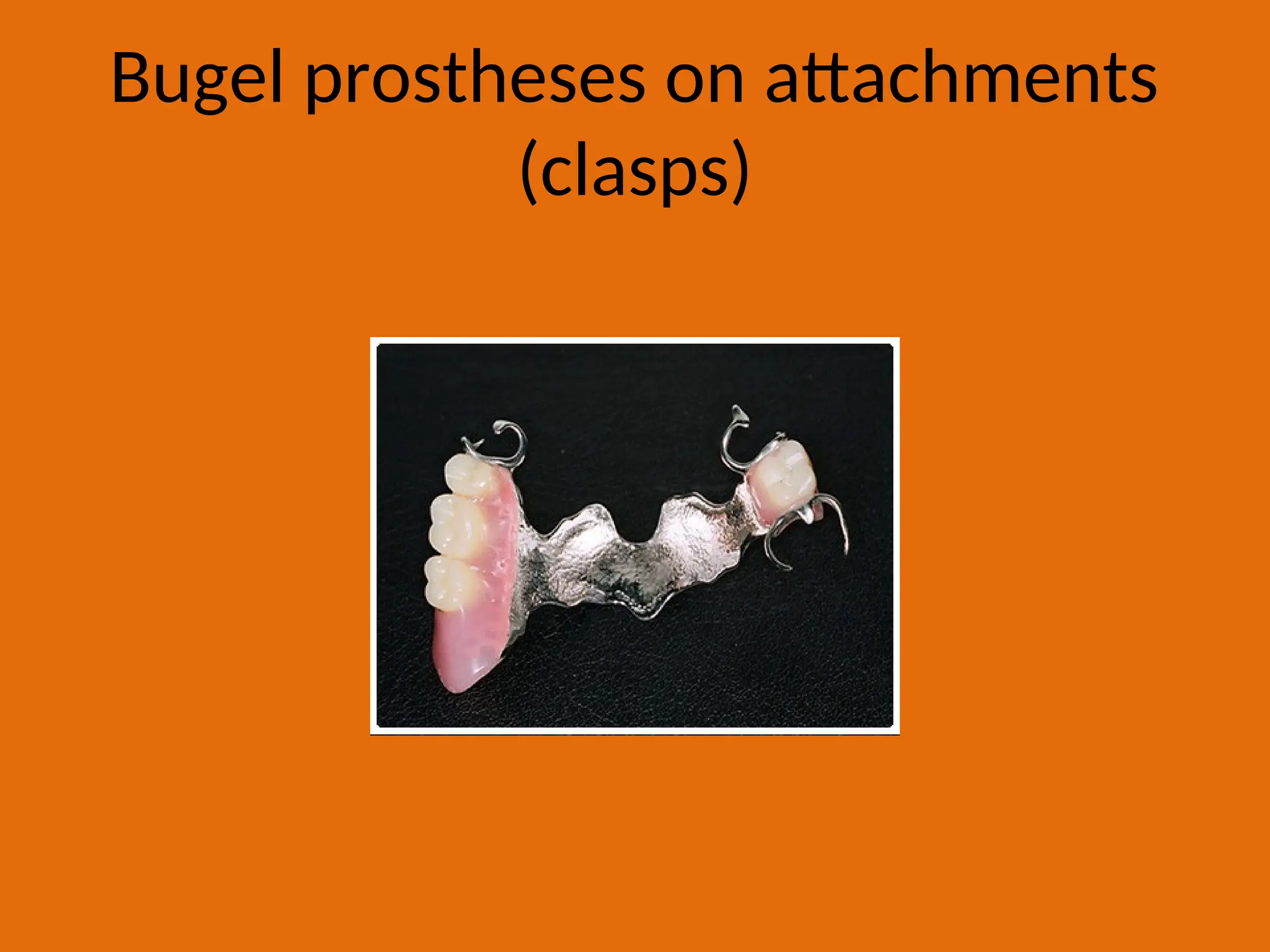 1659908partial denture classification .ppt