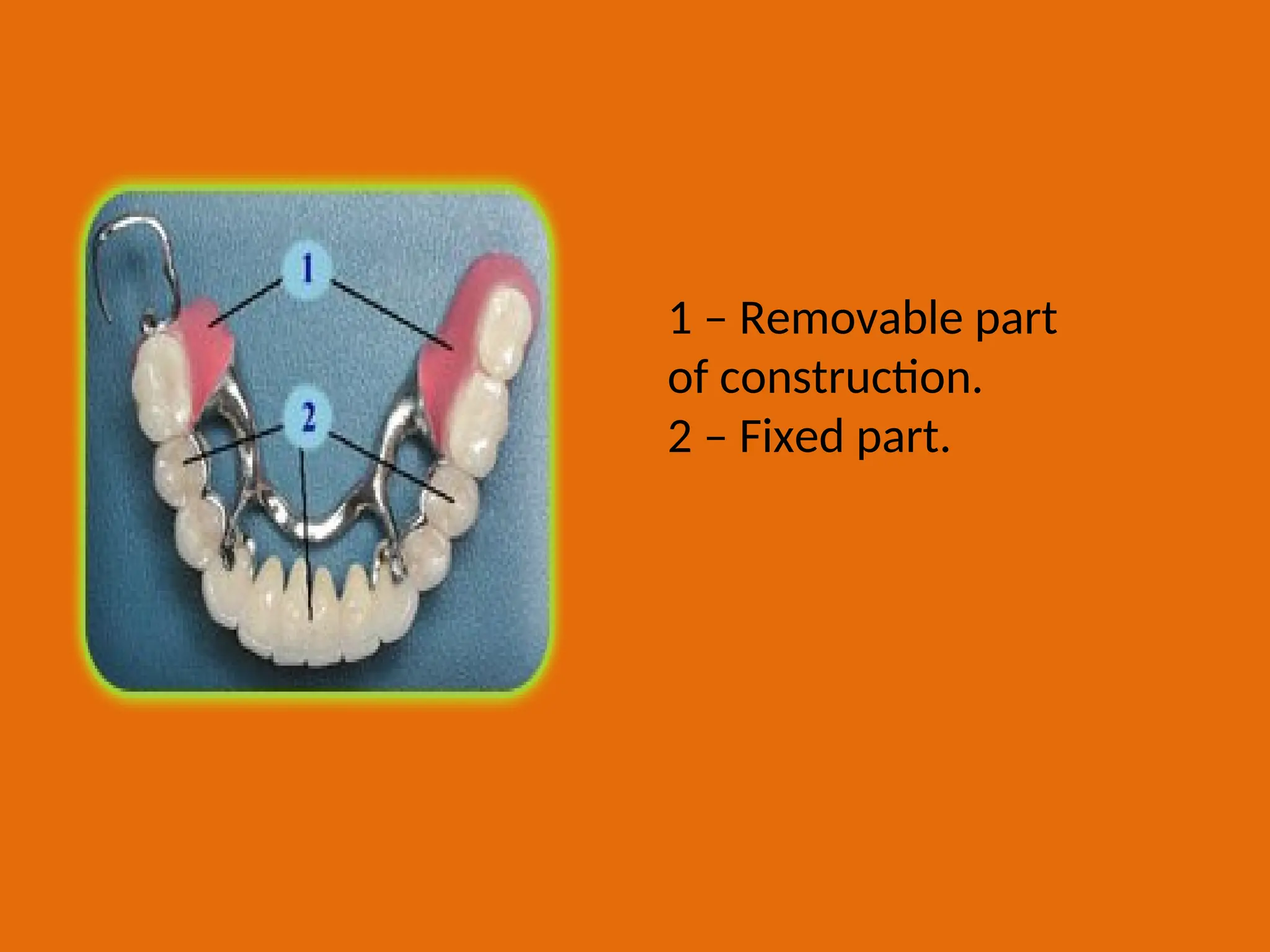 1659908partial denture classification .ppt