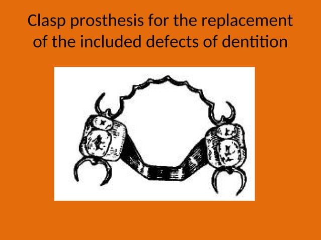 1659908partial denture classification .ppt
