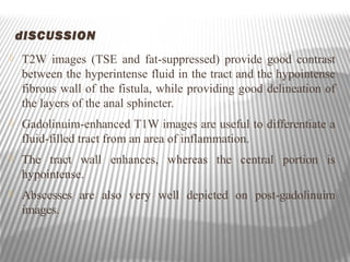 Mri imaging of fistula : its inputs implications for surgical ...