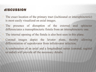 Mri imaging of fistula : its inputs implications for surgical ...