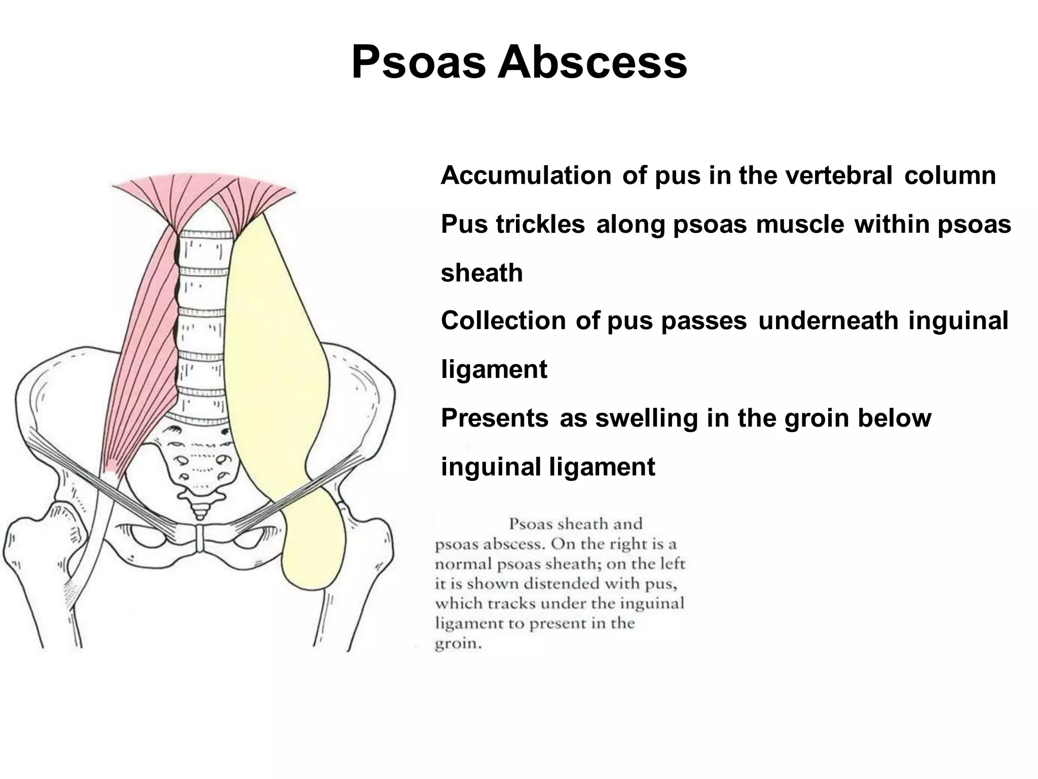 posterior abdominal wall.pdf