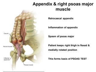 posterior abdominal wall.pdf