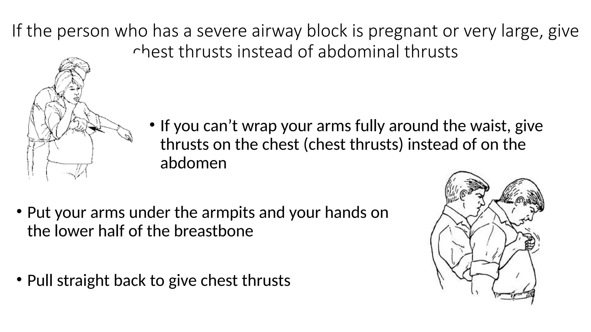 Choking management in adult and children | PPT
