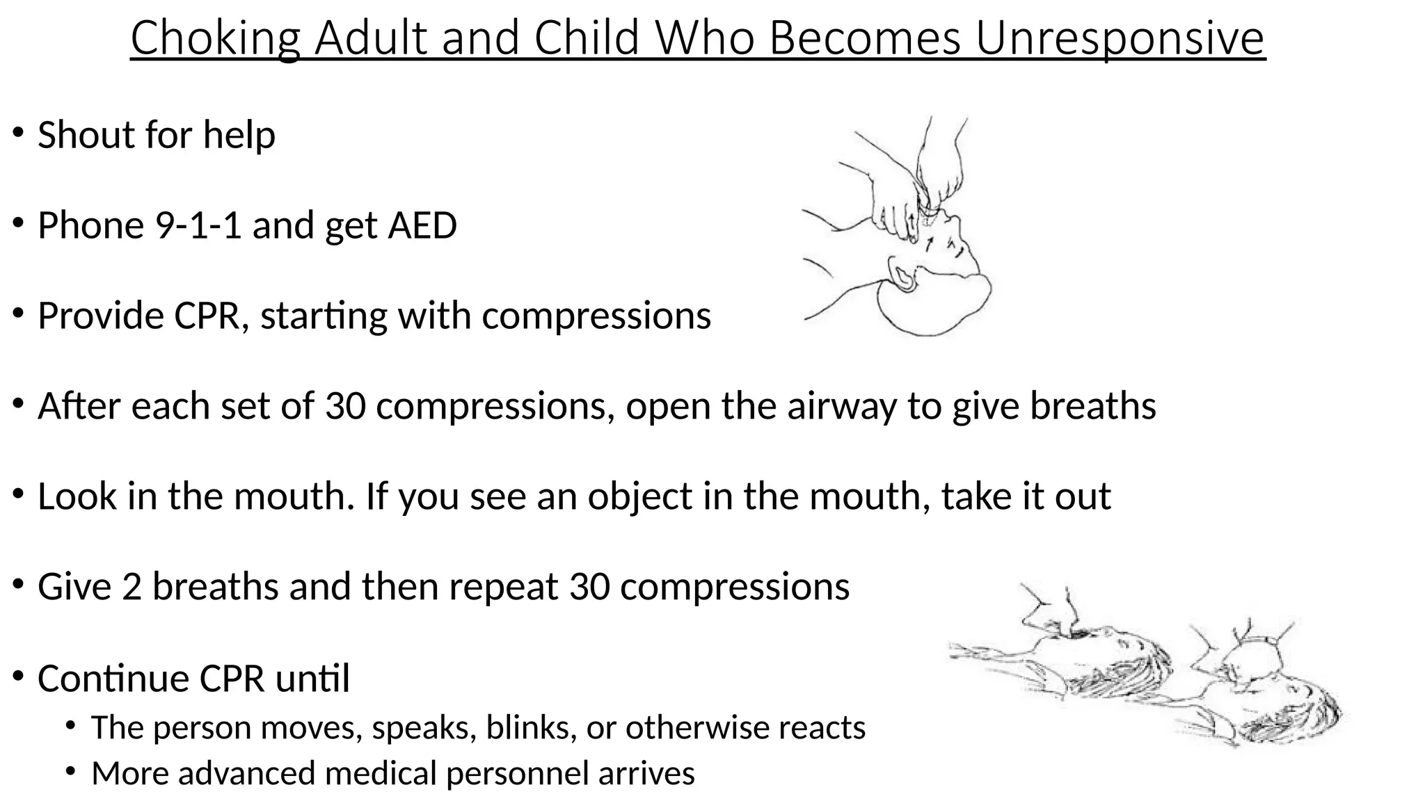 Choking management in adult and children | PPT