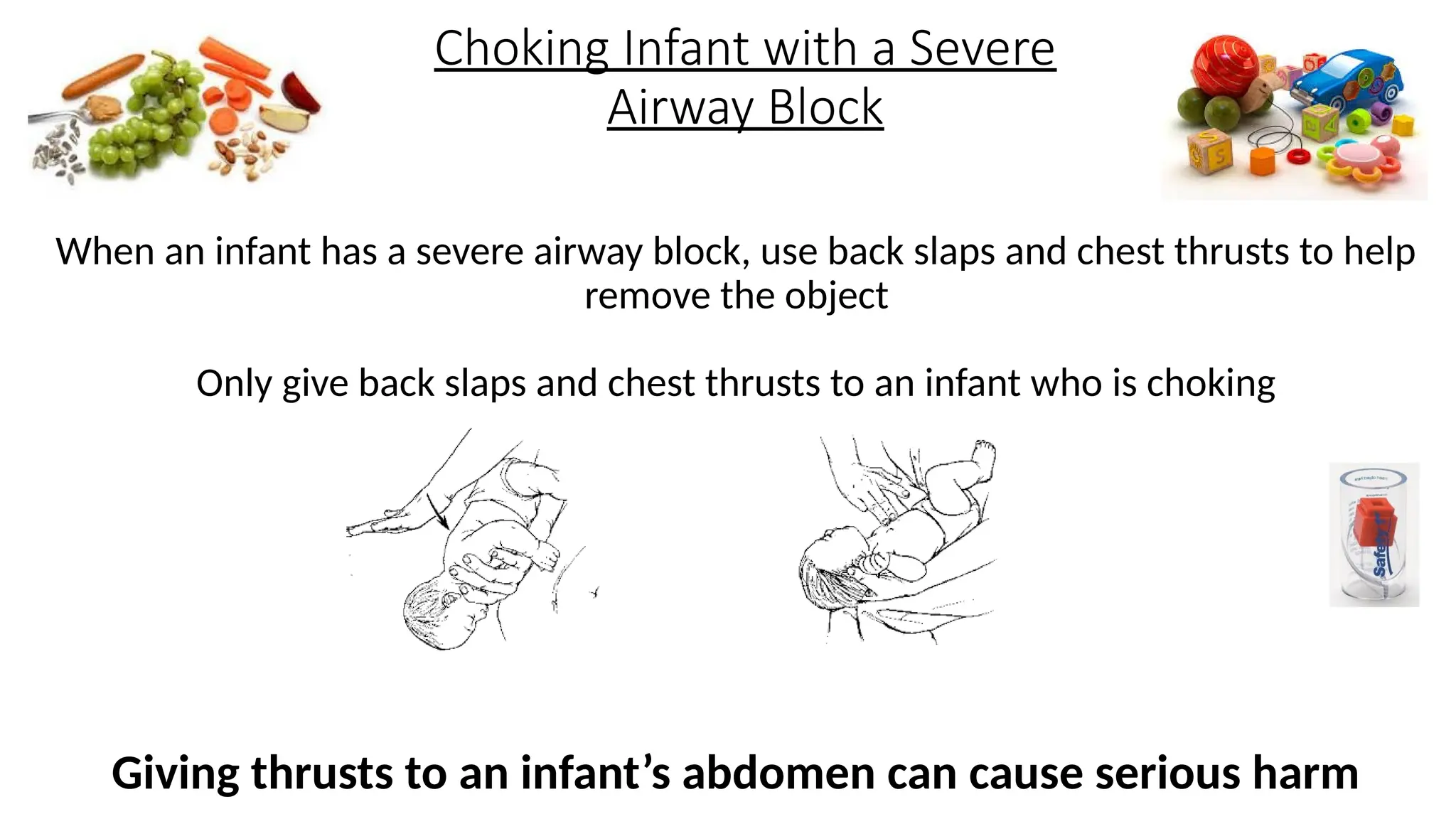 Choking management in adult and children | PPT
