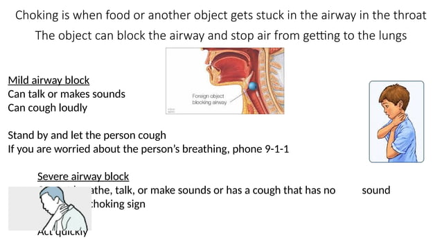 Choking management in adult and children | PPT | First Aid | Injuries