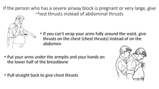 Choking management in adult and children | PPT