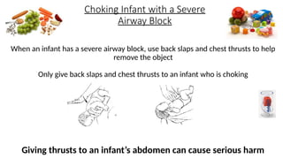 Choking management in adult and children | PPT