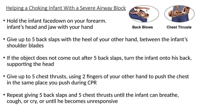 Choking management in adult and children | PPT | First Aid | Injuries