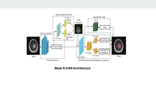 Mask RCNN on brain tumor.pptx