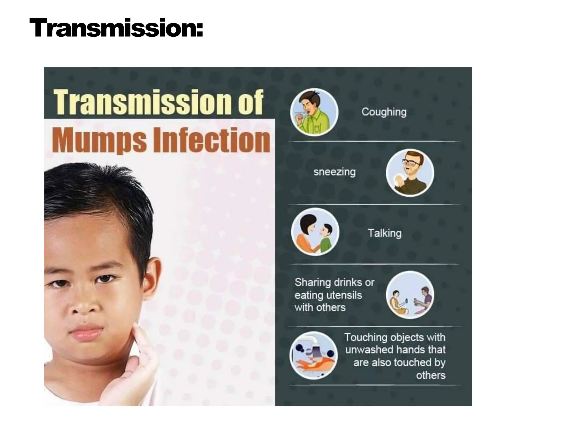 Mumps virus.pptx