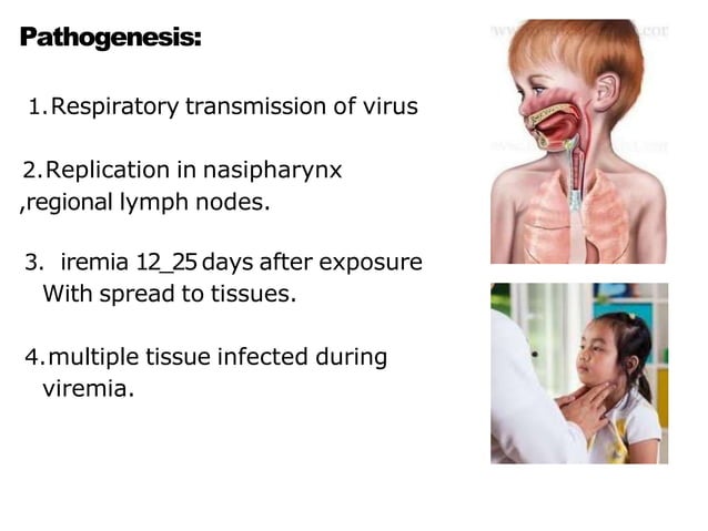 Mumps virus.pptx | Infectious Diseases | Diseases and Conditions