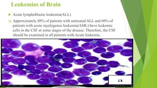 Cerebrospinal fluid CSF.pptx
