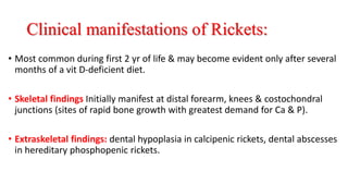 Osteomalacia & Rickets | PPTX | Bone and Joint Conditions | Diseases ...
