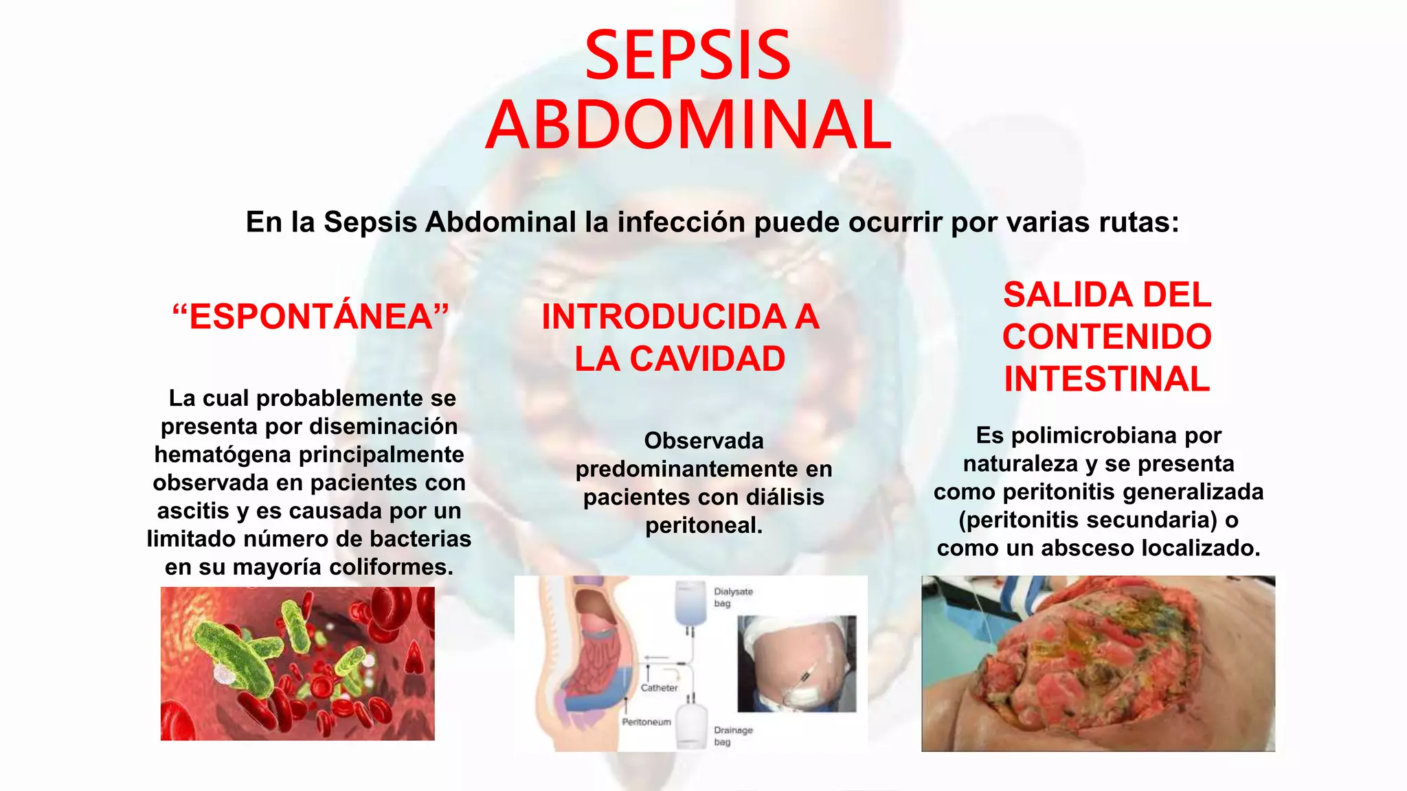 1684277267640_SEPSIS ABDOMINAL.pptx