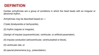 1685644652805_1685644176287_1685644169732_CARDIAC ARRYTHMIAS AND ...