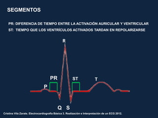 ELECTROCARDIOGRAMA para estudio de medicina | PPTX