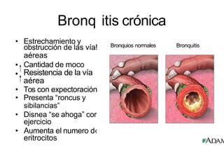 Respiratorio fisiopatologia de patologias | PPTX