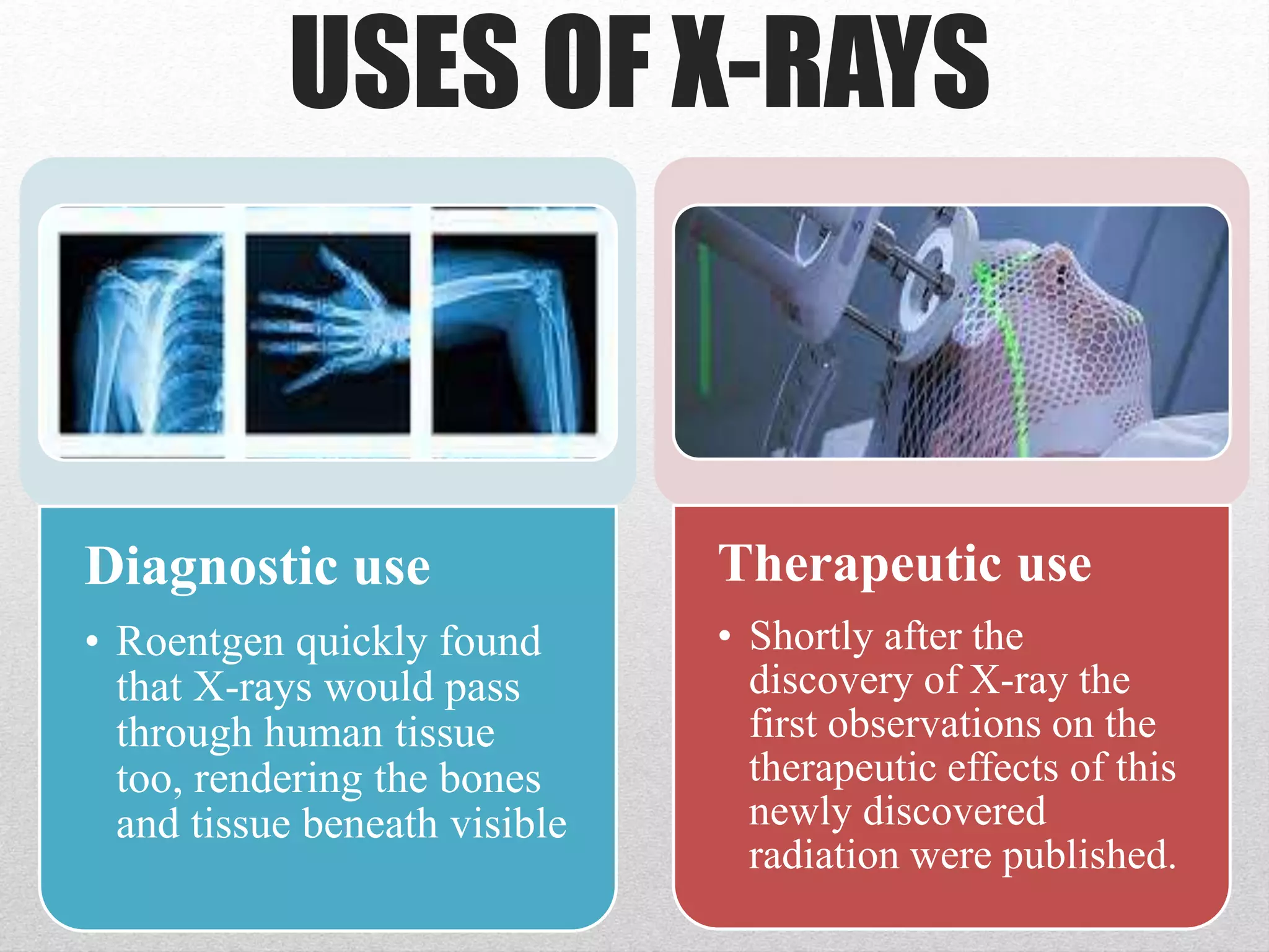 Protocol of Dental Treatment in Radiotherapy Indicated Patients.pptx