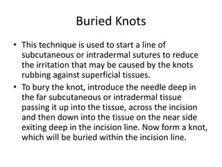 suturing and wound closure made easy in this | PPT