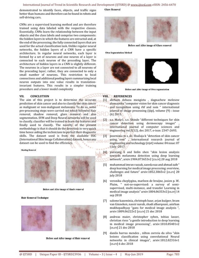 Melanoma Skin Cancer Detection using Image Processing and Machine ...