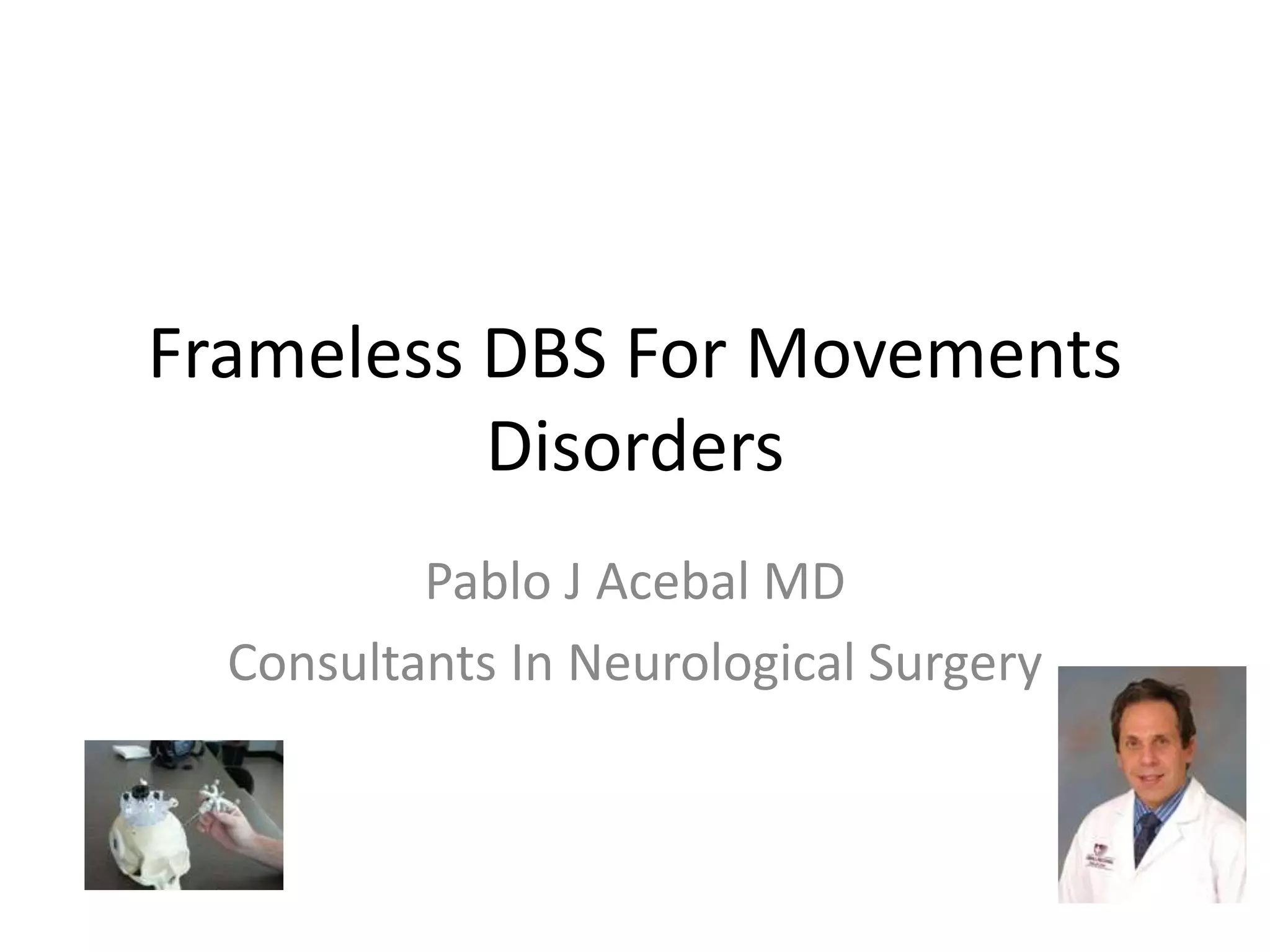 Frameless DBS For Movements Disorders | PPTX