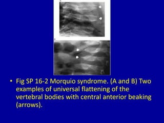 16 beaked, notched, or hooked vertebrae | PPTX
