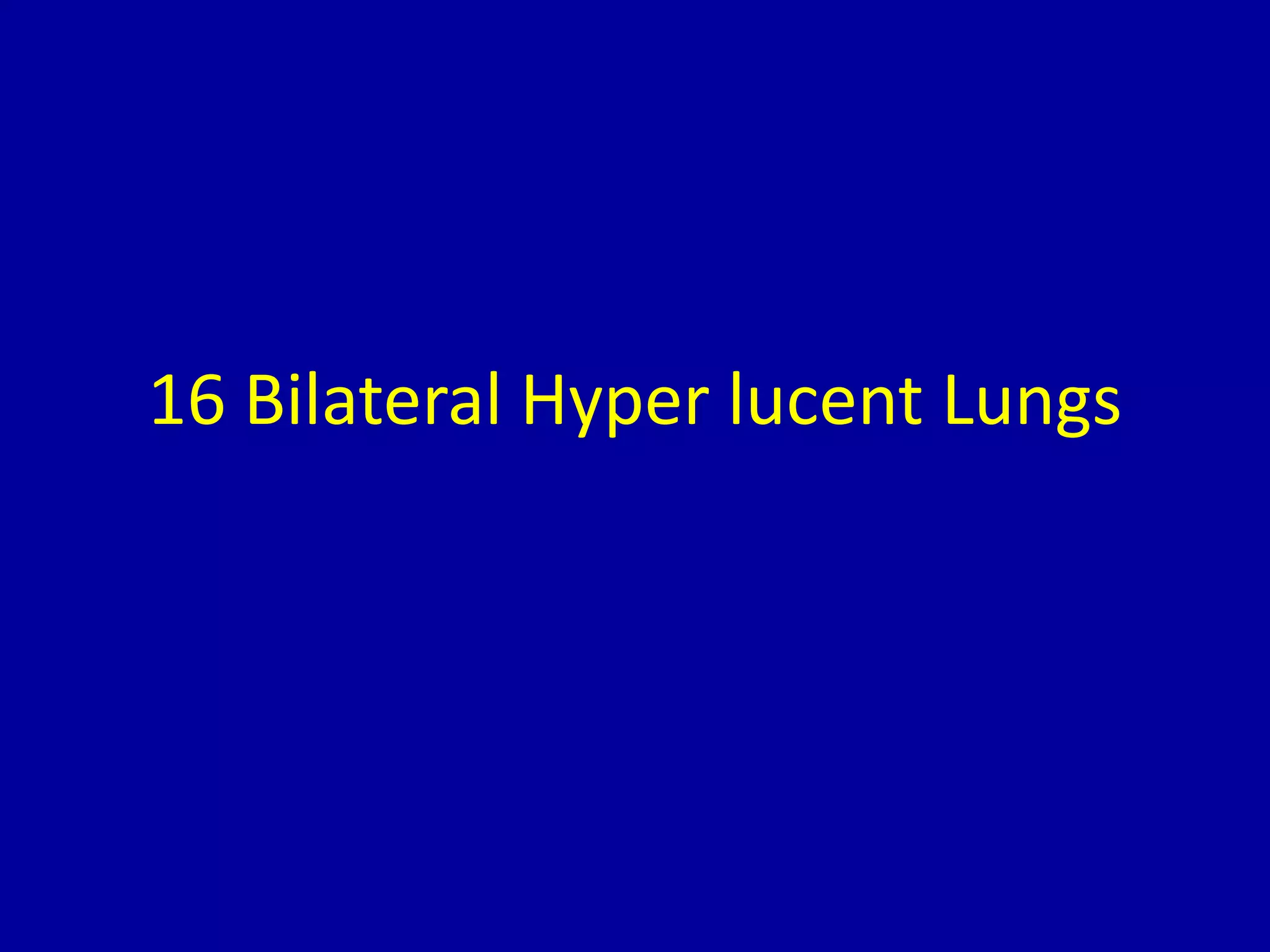 16 bilateral hyper lucent lungs | PPT