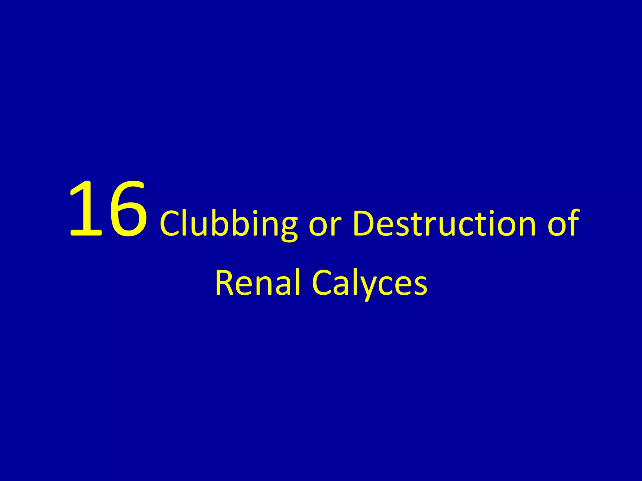 16 clubbing or destruction of renal calyces | PPTX