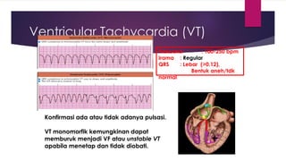 16 Drugs & Defibrilations | PDF