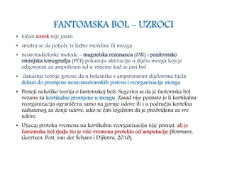 fantomska bol | PPTX