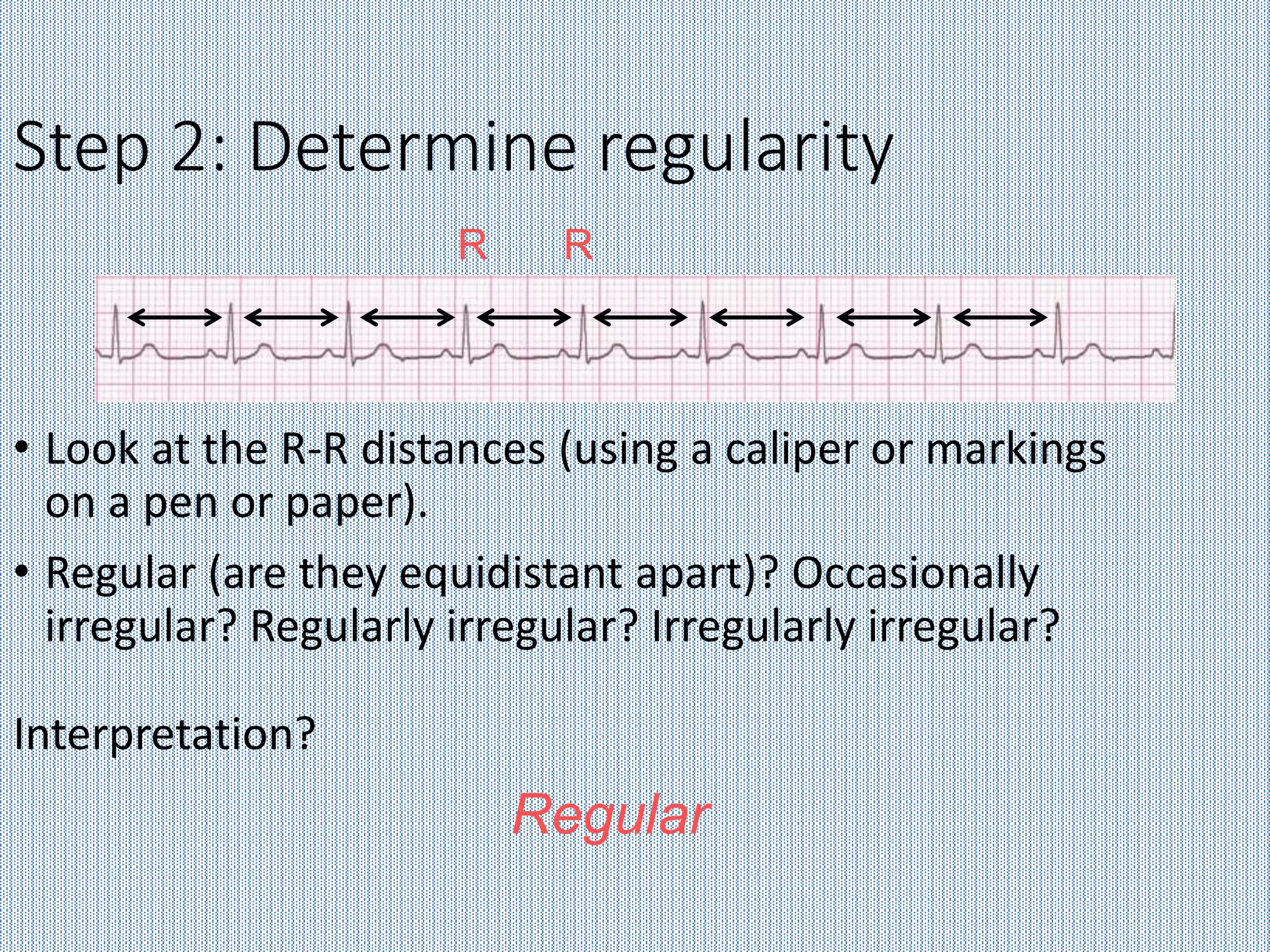 Interpretation of ECG lab session.ppt