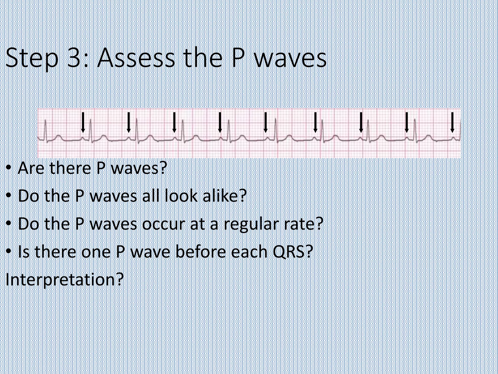 Interpretation of ECG lab session.ppt
