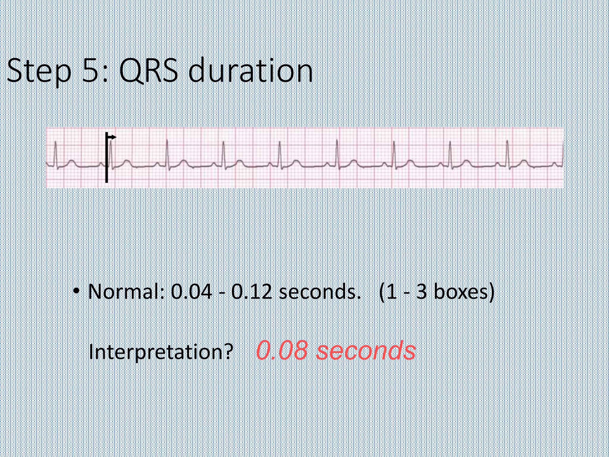 Interpretation of ECG lab session.ppt