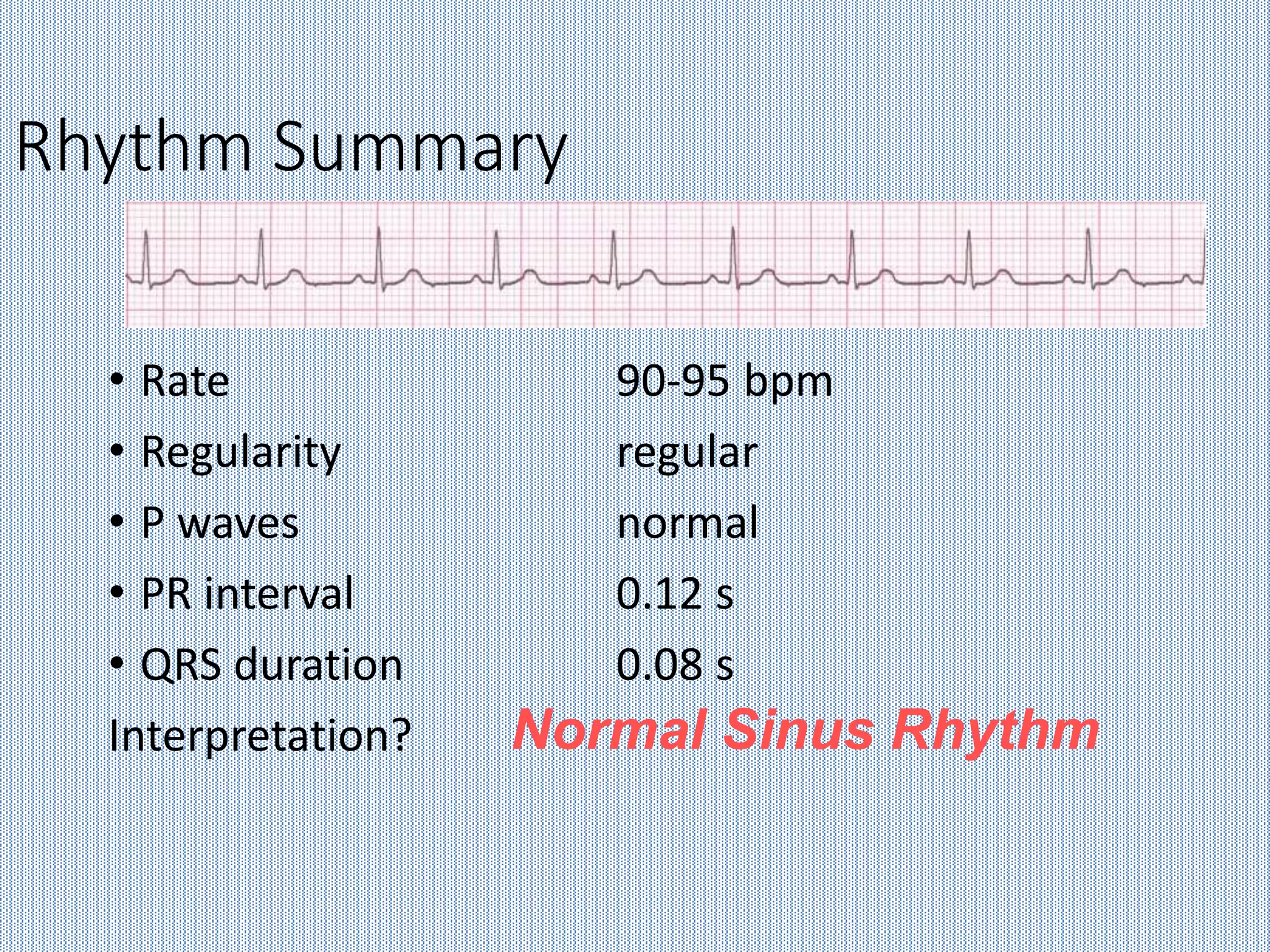 Interpretation of ECG lab session.ppt