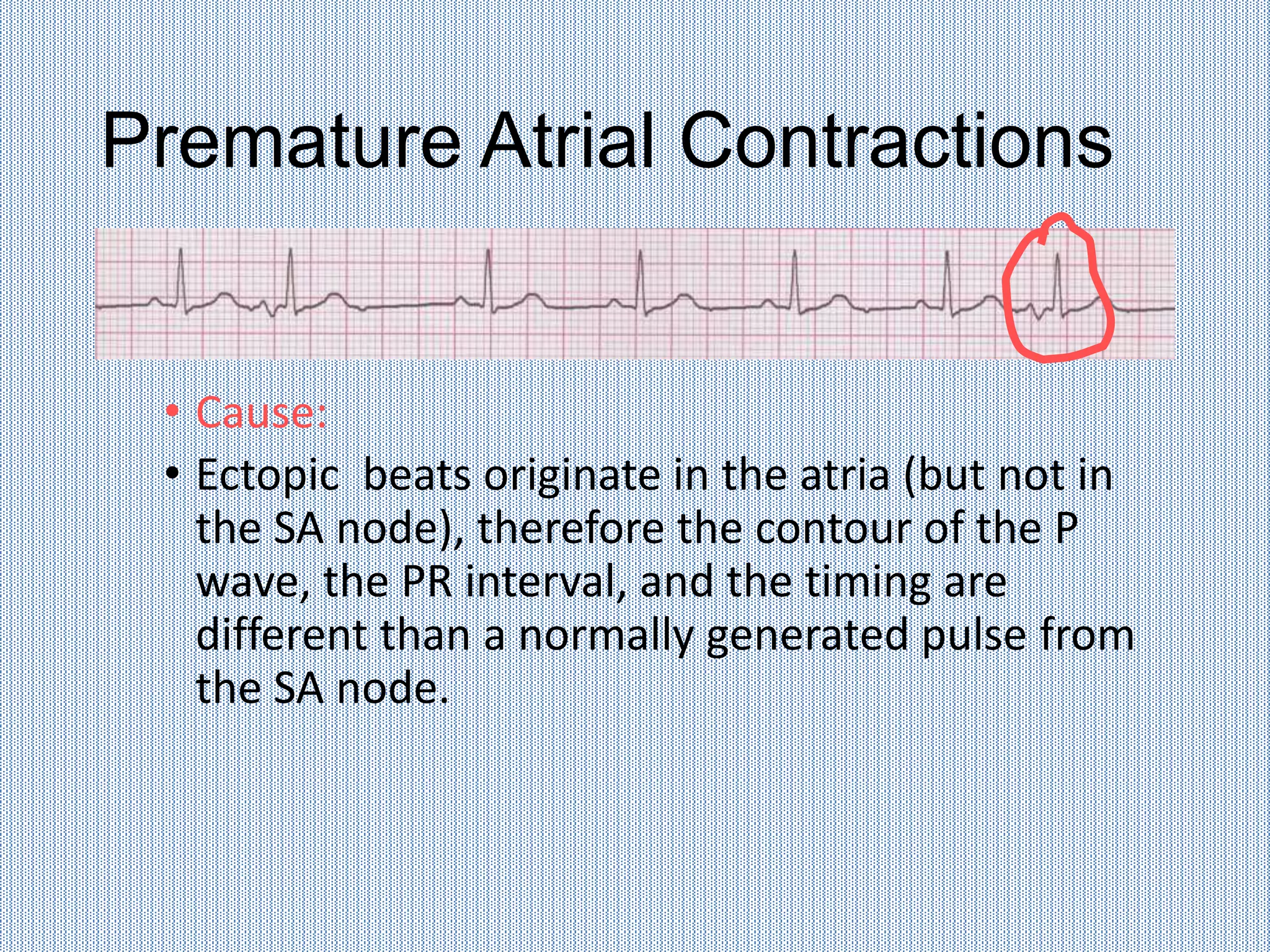Interpretation of ECG lab session.ppt